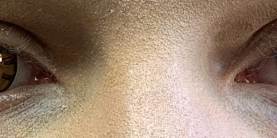 The most Vibrant Pink Lenses for Brown Eyes - UNIQSO
