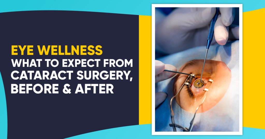 Eye wellness: What to Expect From Cataract Surgery, Before & After
